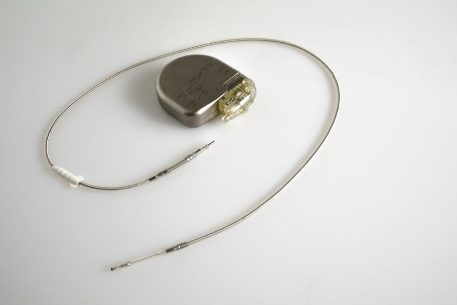 Electrical storms in ICD patients explained