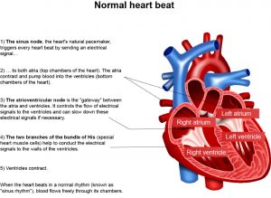 The Normal Heart Rhythm and Anatomy | My Rhythm Device